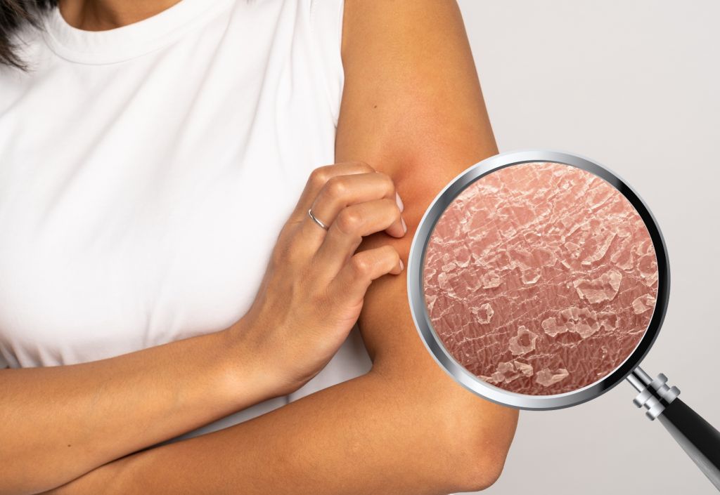 What is sensitive skin and how to identify it? - Druide